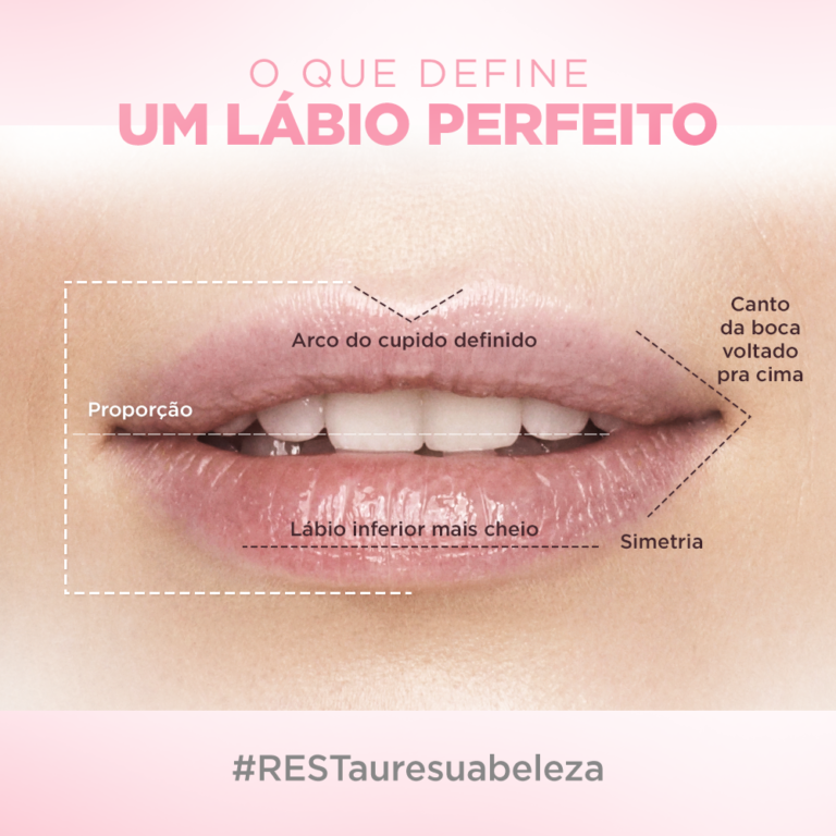 Escultura Labial - DR Igor Ramos